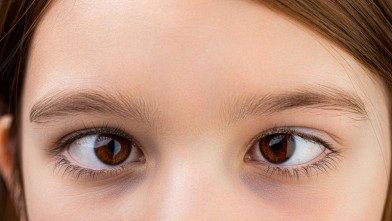 Ketahui Penyebab Mata Juling dan Cara Mengobatinya - EMC Healthcare - SAME