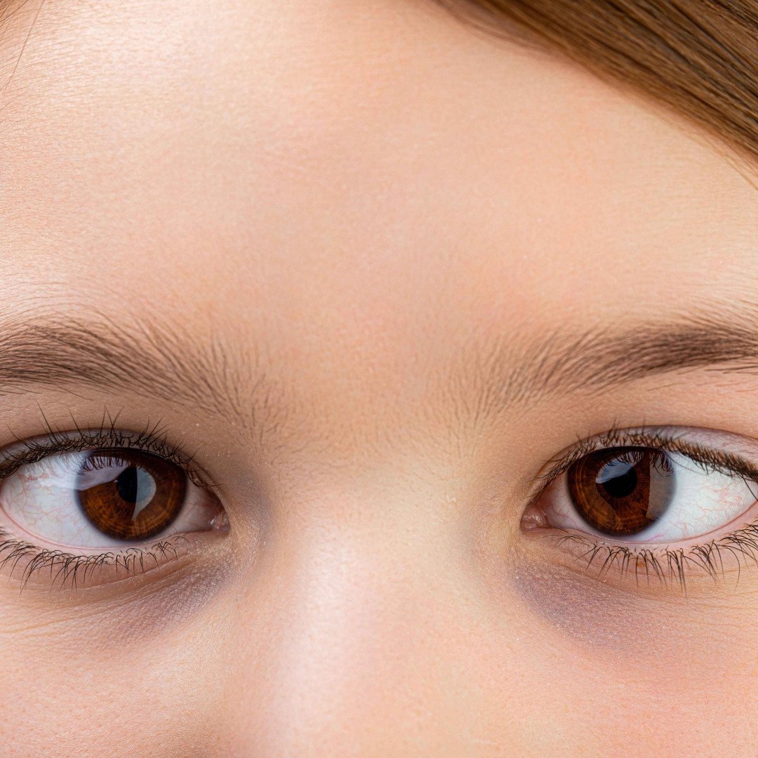 Ketahui Penyebab Mata Juling dan Cara Mengobatinya - EMC Healthcare - SAME