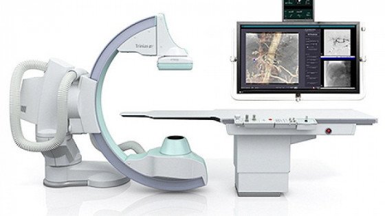 Mengenal Metode Diagnosis Terkini Digital Subtraction Angiography Dsa