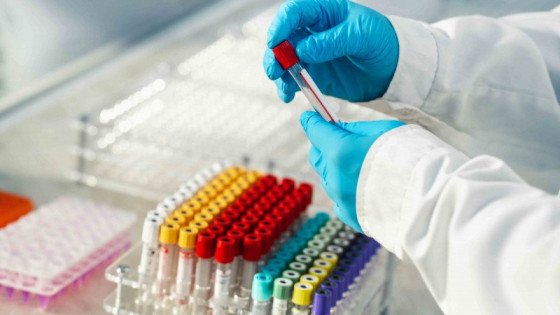 Prevent Before It's Too Late: The Importance of Laboratory Testing for ...